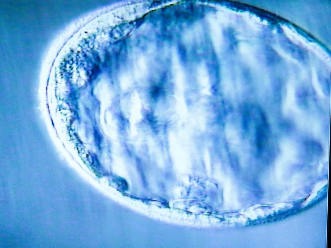 Conceiving Conception: When Does Implantation Occur - LittleOneMag